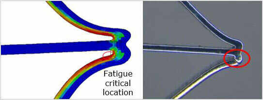 Structural Optimization Med Institute Computational Modeling