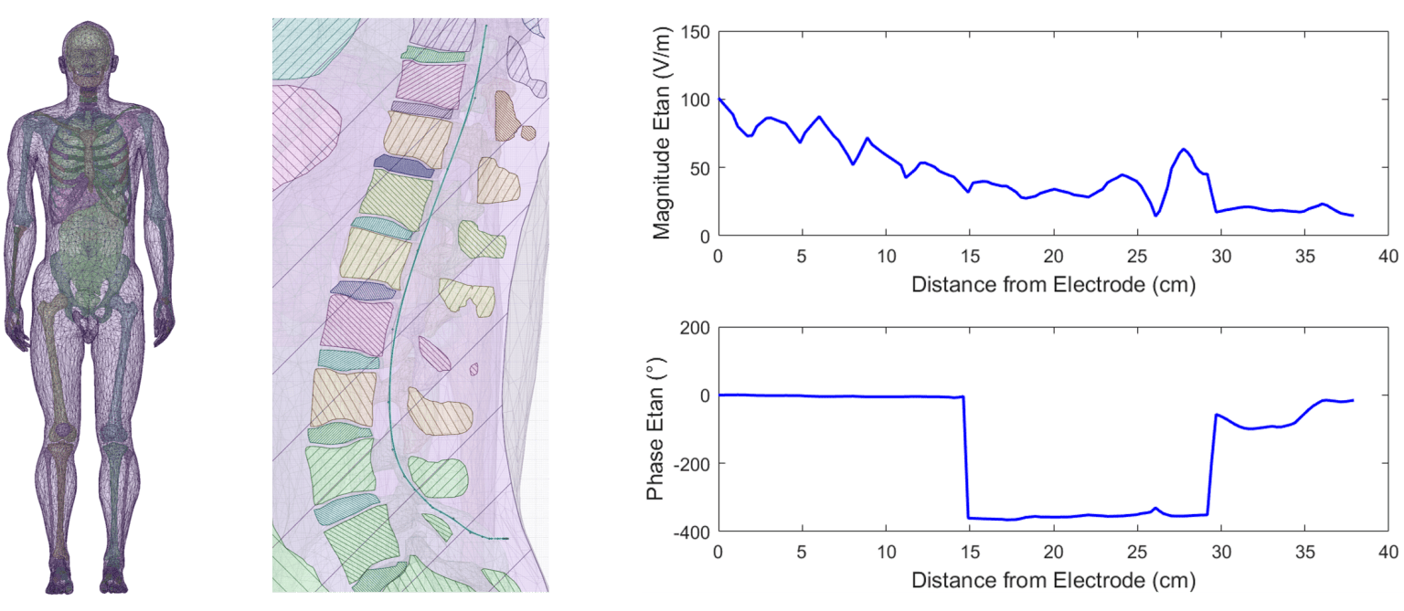 Active Implantable Medical Device (ISO/TS 10974) – MED Institute