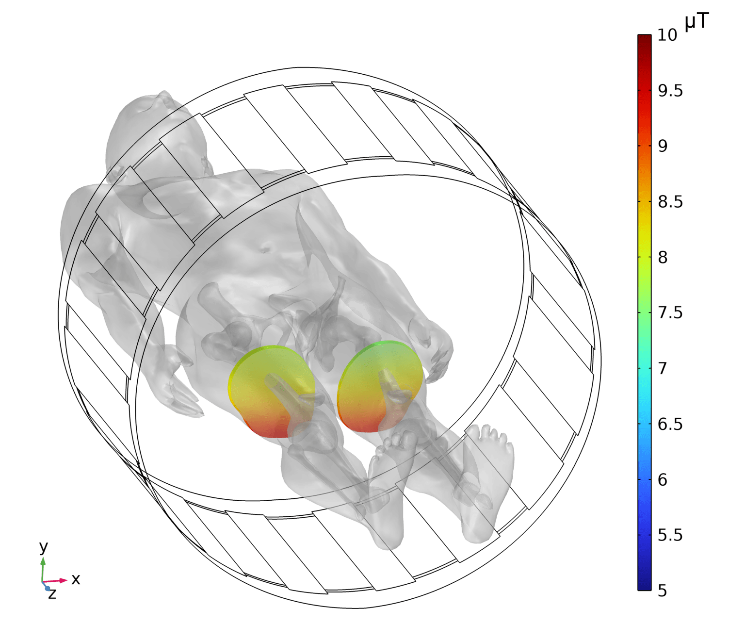 B1+RMS limits on MR Conditional labeling – MED Institute