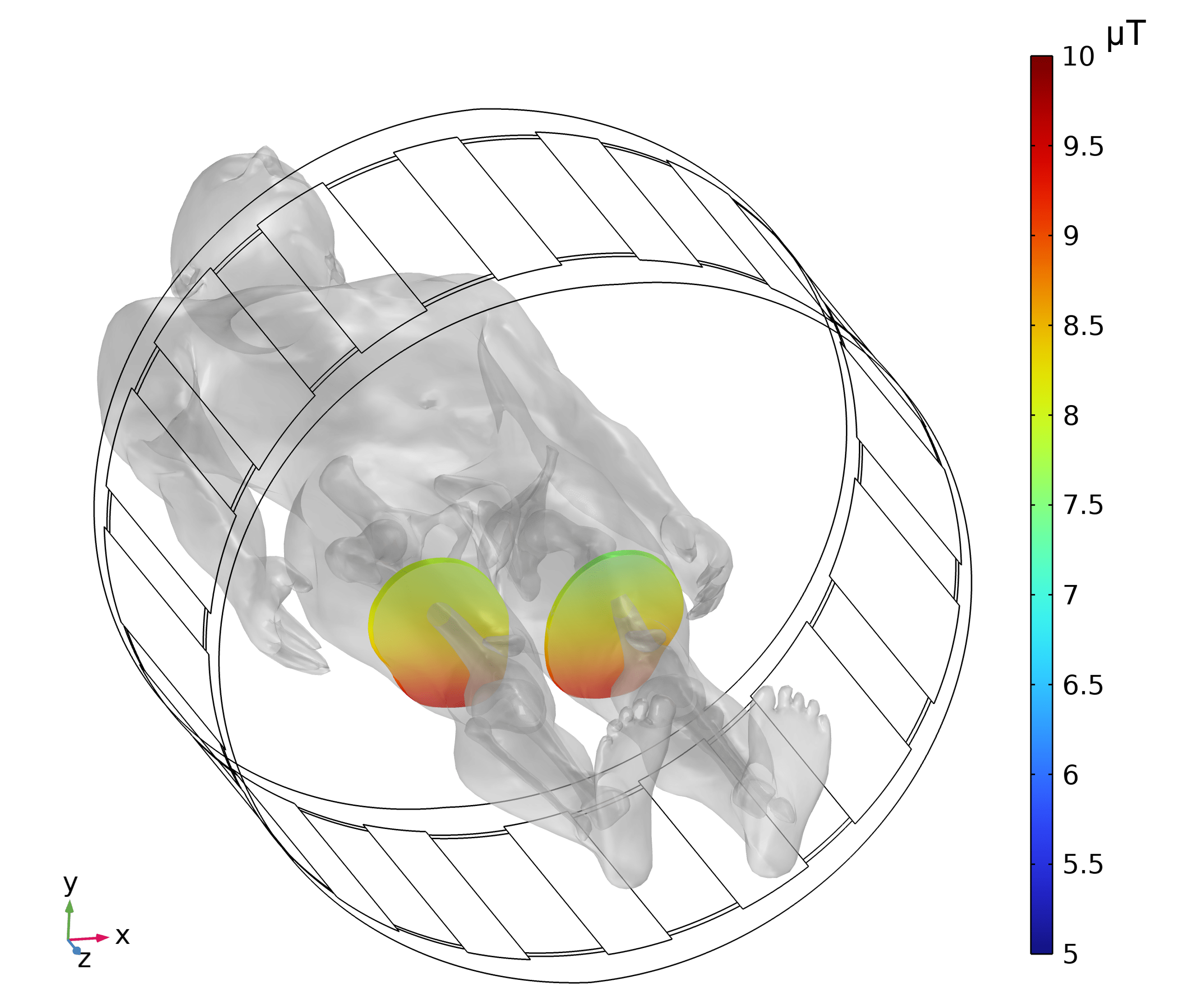 B1+RMS limits on MR Conditional labeling – MED Institute